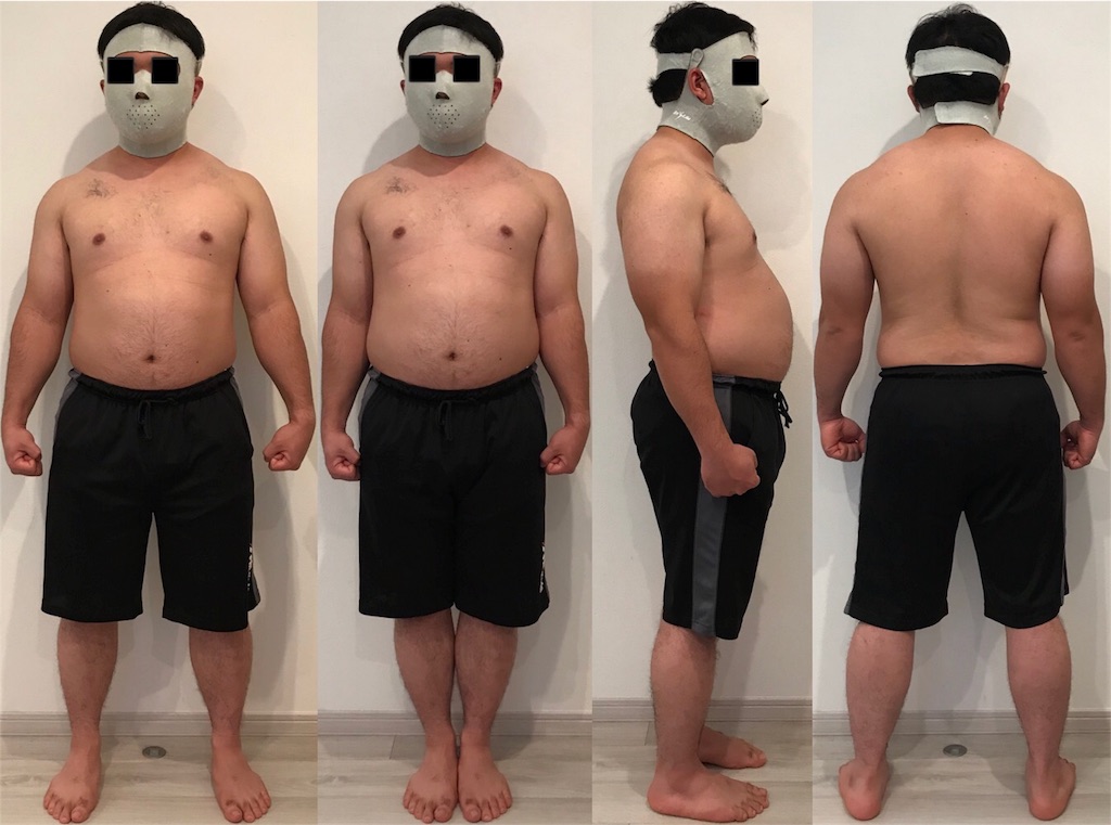 運動記録 再278日目 - 実験体Aの日記