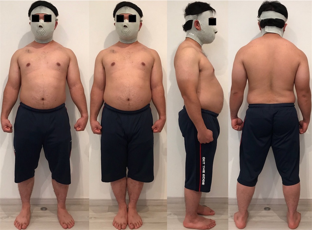 運動記録 再281日目 - 超人間主義者Aの日記