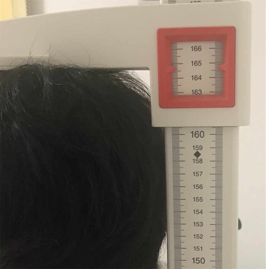 今日の身長測定 156日目 - 実験体Aの日記