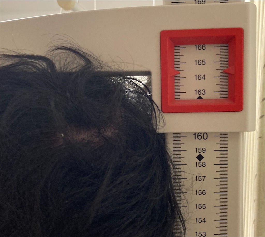 身長測定 再開22日目 - 超人間主義者Aの日記