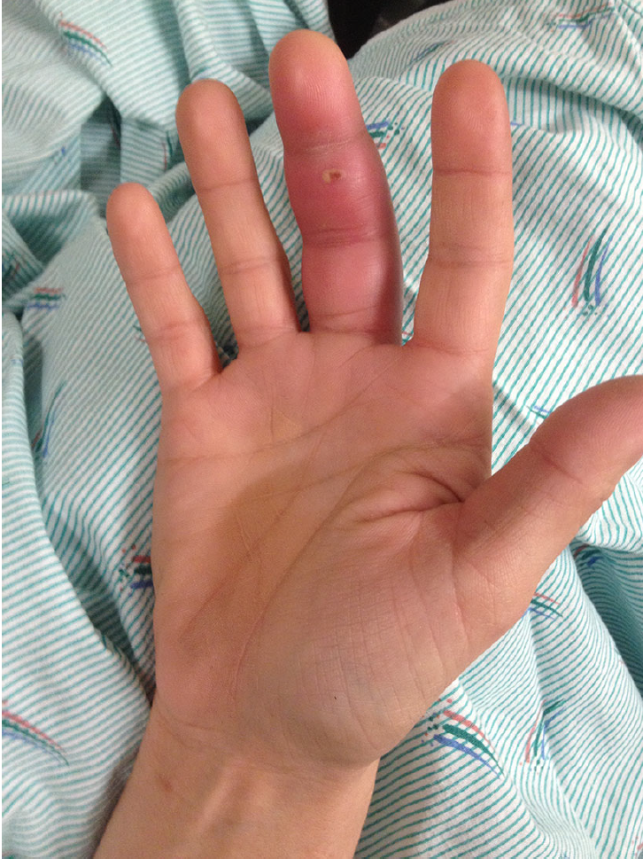 動物咬傷② 病歴聴取、身体所見、検査など - りんごの街の救急医