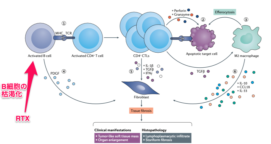 IgG4関連疾患レビュー - 膠原病・リウマチ一人抄読会