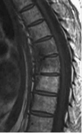 SAPHO症候群の診断・画像所見 - 膠原病・リウマチ一人抄読会