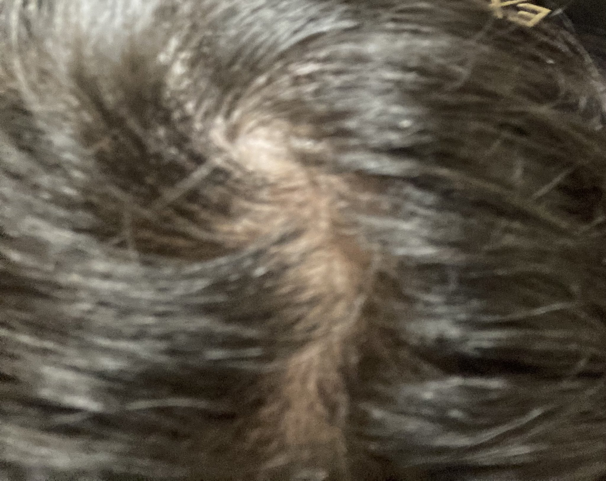 育毛サプリメントで薄毛や髪の悩みを解決！「volumore」は効果があるのか？お試し結果のレビュー！ - Q太郎とシュゾー2匹の仲良しだいありー