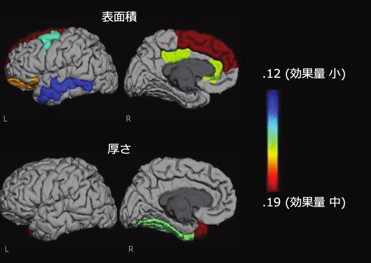 【ADHDの脳皮質の脳画像（MRI）から分かった発達の障害】 - RIDC_JPのブログ