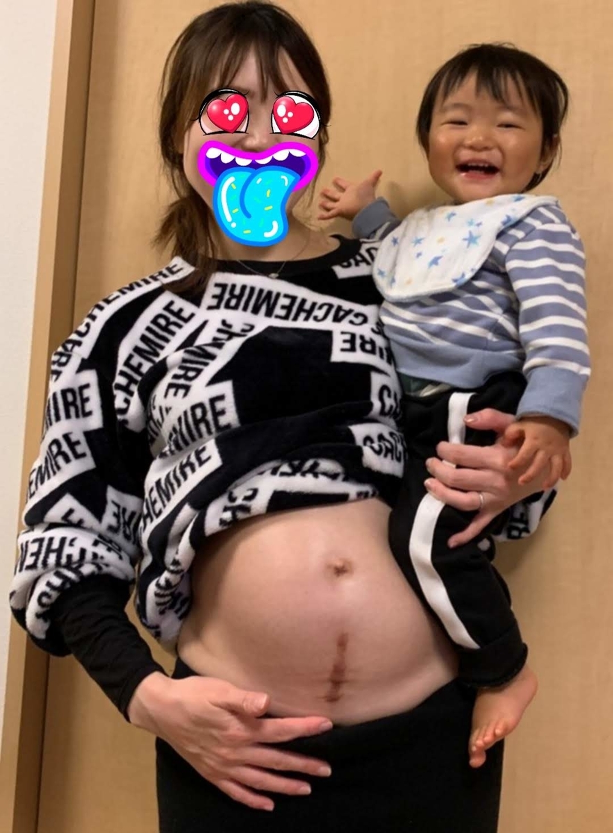 里帰り…帝王切開って… - 💄RISUI DIARY💄