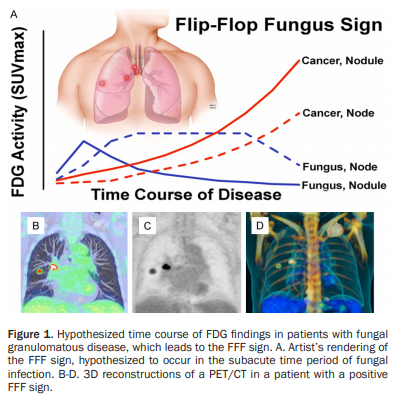 Flip-flop fungus sign[手がかりとしてはいいかも？] - BBBIP