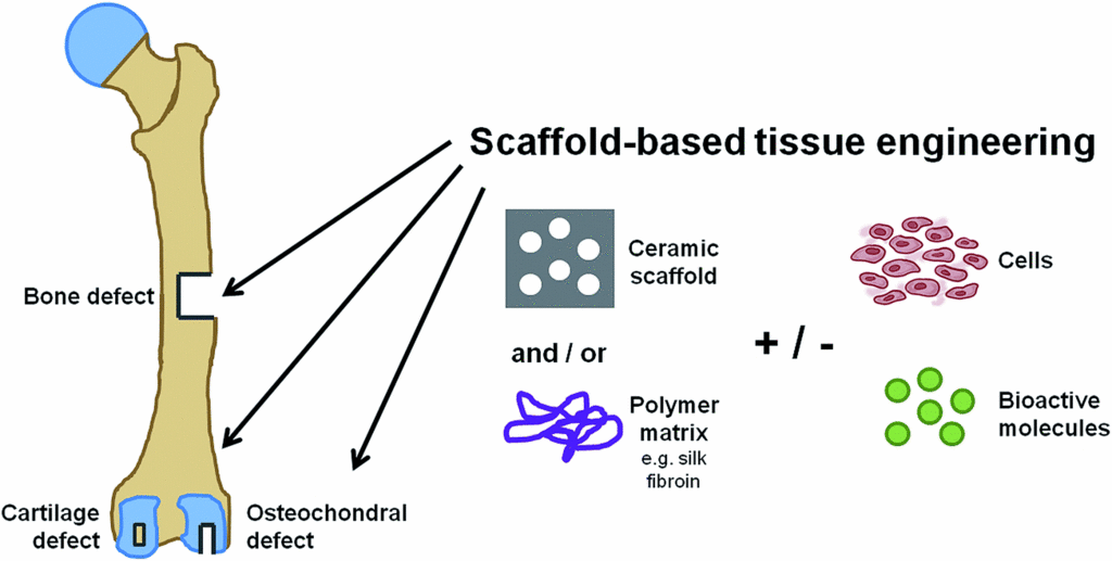 The Application of 3D Printing Technology in Bone Tissue Scaffold ...