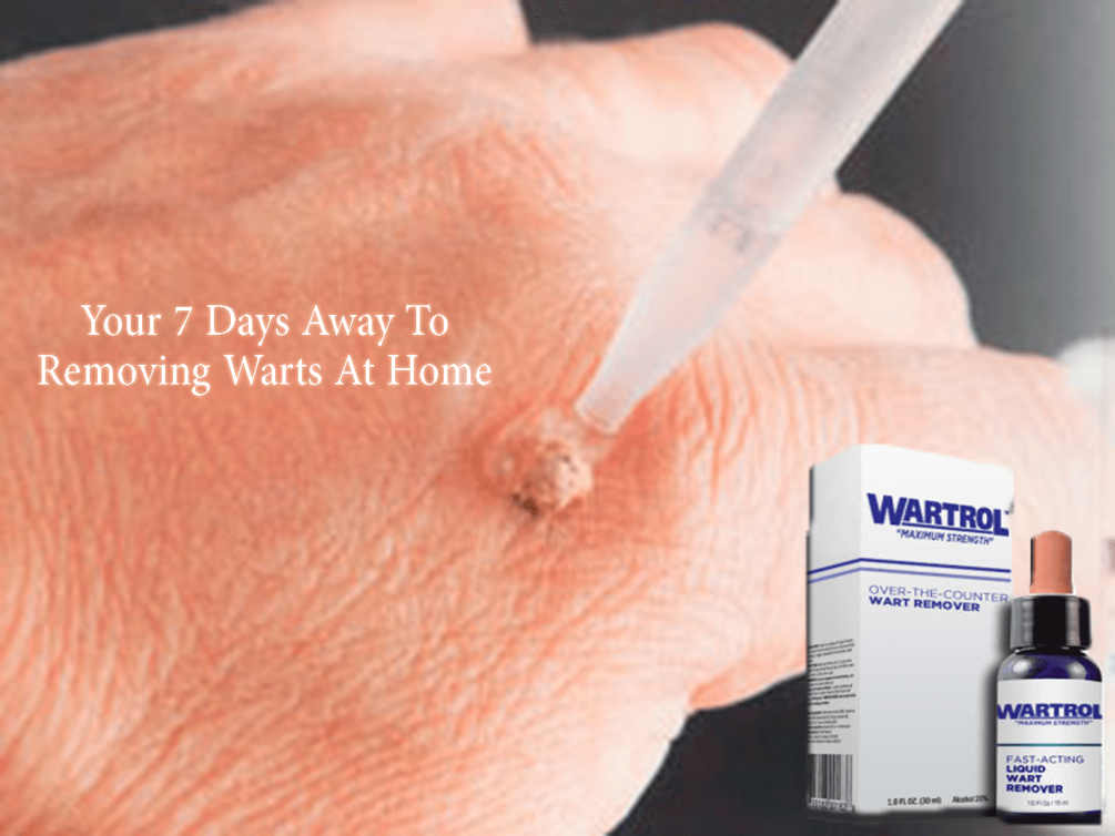 Wartrol Wart Remover Review-Price,Side-Effects & Where To Buy? - Health ...
