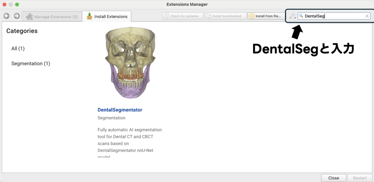 macbook airでもできる！CTから顎骨・歯のSTLデータの切り出し！ - ラクラミのデジタル・デンタル・タメになる！