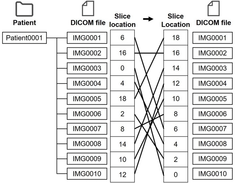 【MATLAB】DICOM画像をスライス順に並び替える - Akima Blog