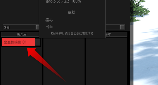 【SCUM】食事・治療の仕方は？ - MBTI風「キャラ診断」研究所
