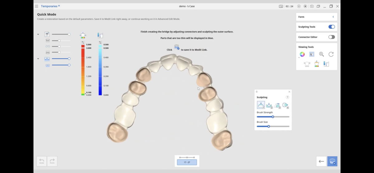 Medit Temporaries 1.1 アップデート レビュー①機能紹介、国内最速レビュー！ - 3D歯科 のデジタル歯医者入門