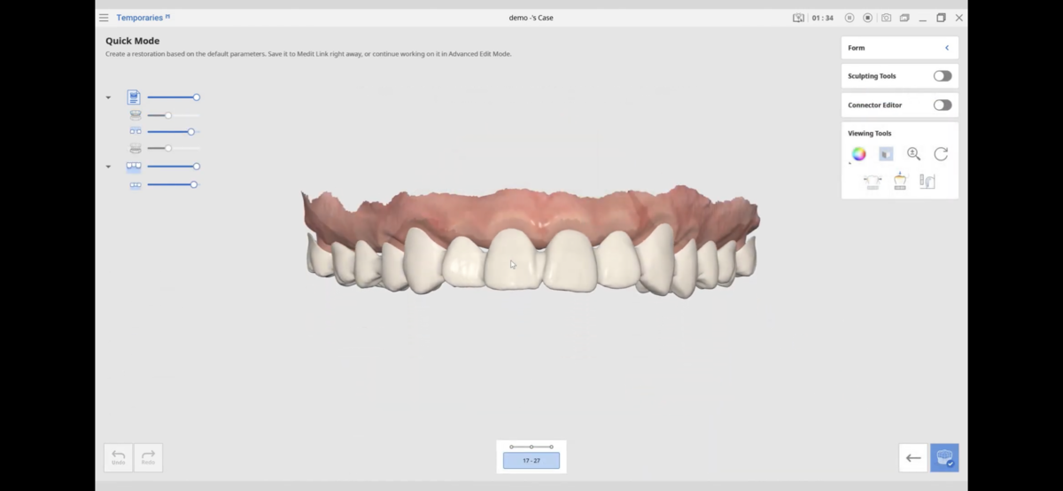 Medit Temporaries 1.1 アップデート レビュー①機能紹介、国内最速レビュー！ - 3D歯科 のデジタル歯医者入門