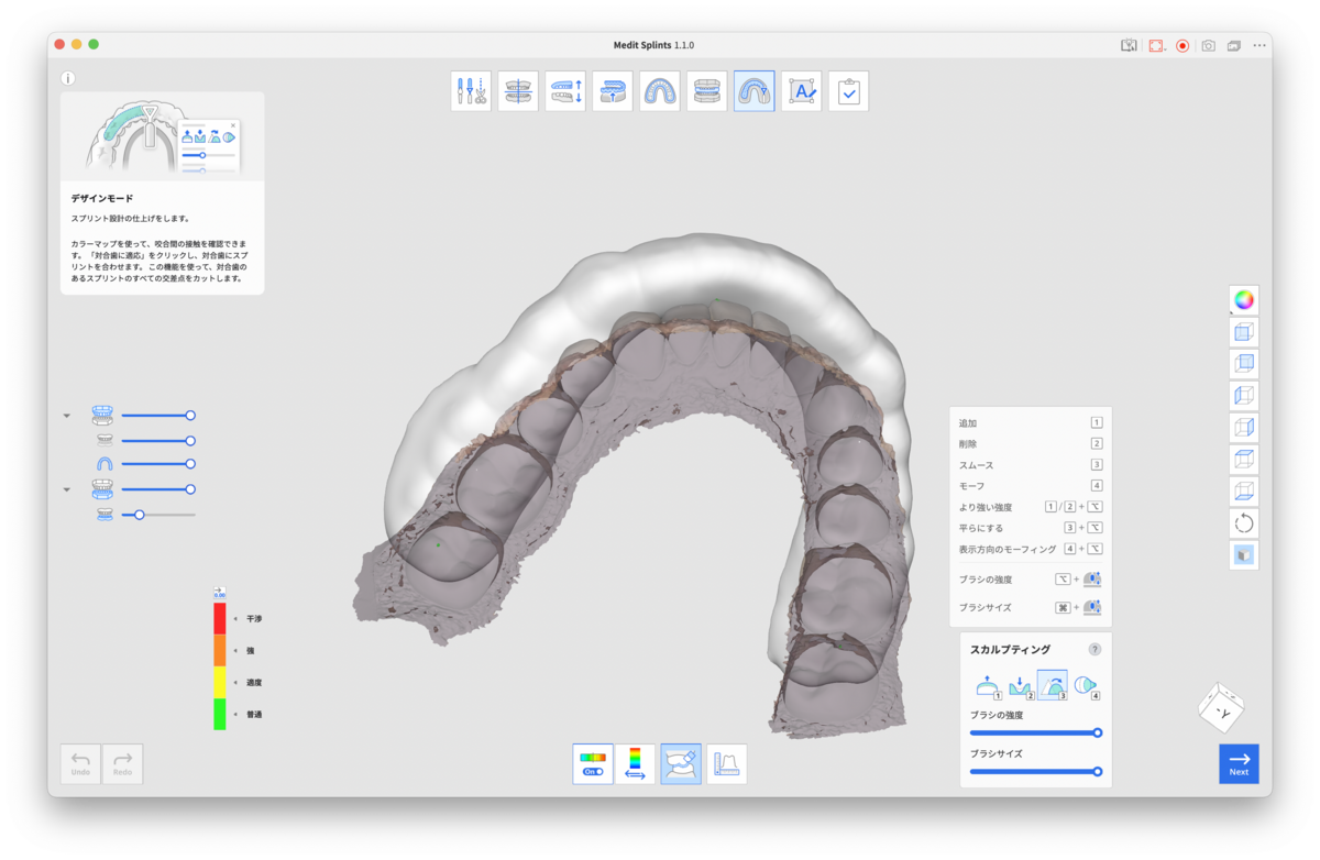 Medit Splints 1.1 アップデート スプリント以外にも使えます！ - 3D歯科 のデジタル歯医者入門