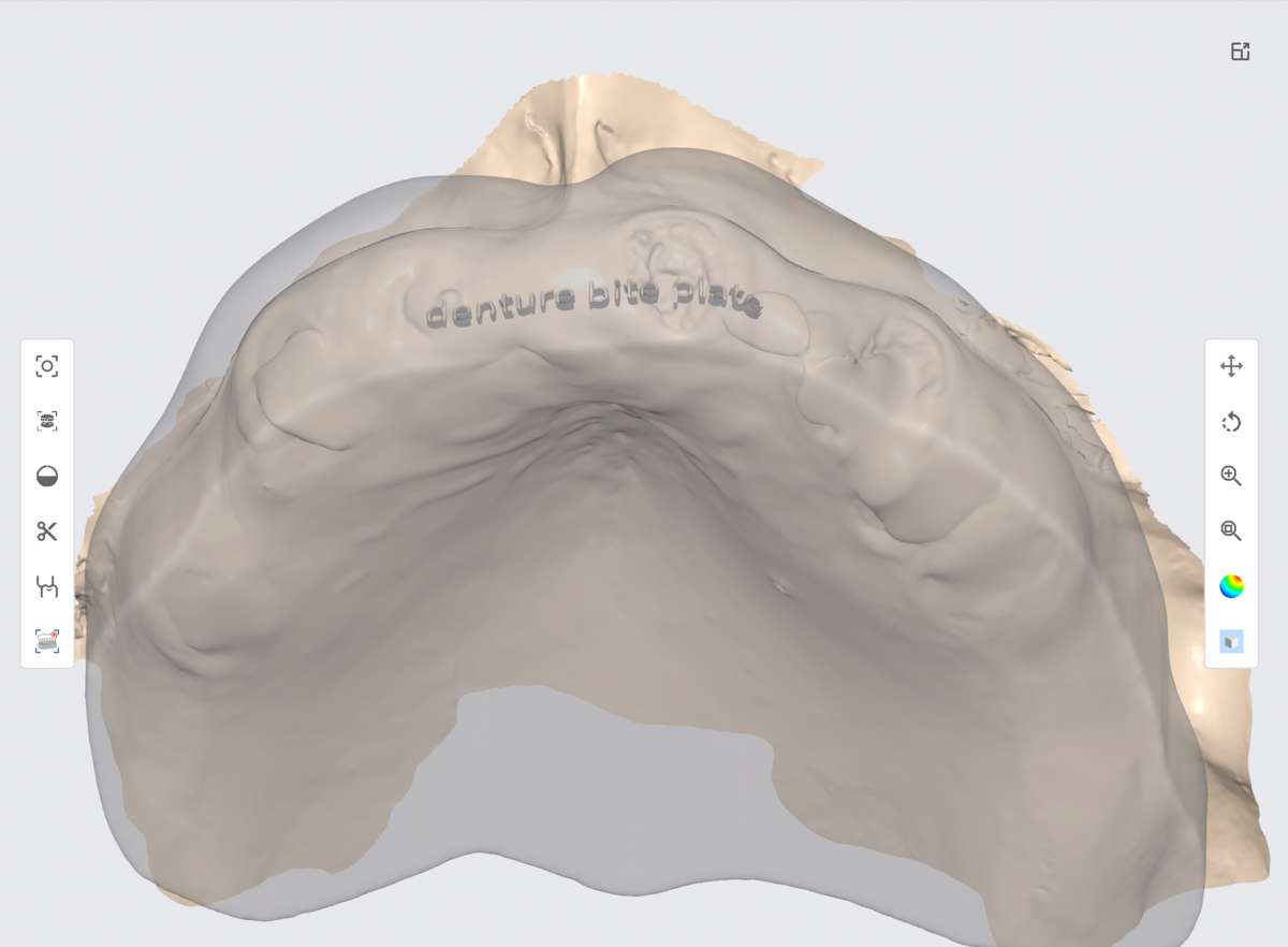 Medit Splints 1.1 アップデート スプリント以外にも使えます！ - 3D歯科 のデジタル歯医者入門