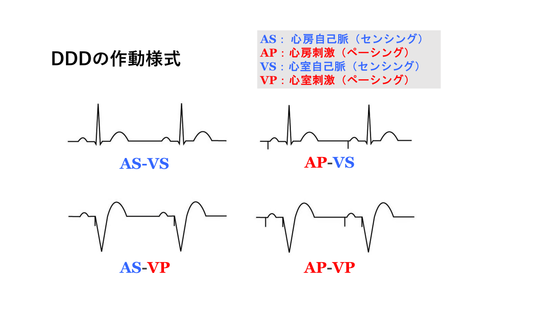 ペースメーカーの基本 - 循環器内科医の本棚