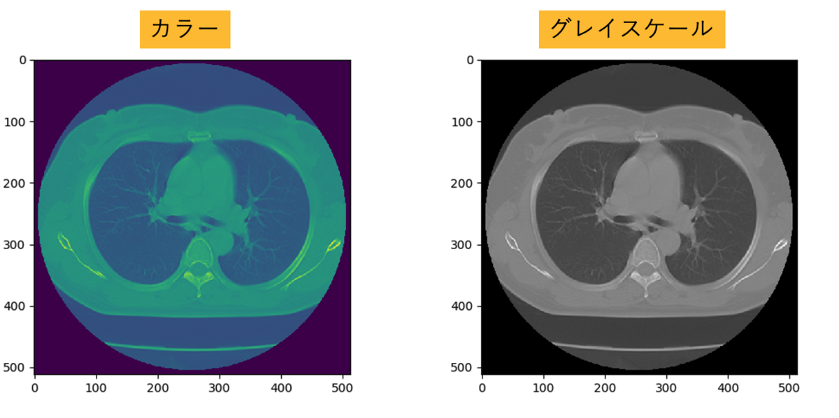 【python】dicom画像 Dcm を画像へ変換 ガラナが飲みたい