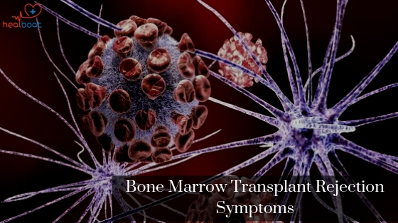 Bone Marrow Transplant Rejection Symptoms - healboat’s blog