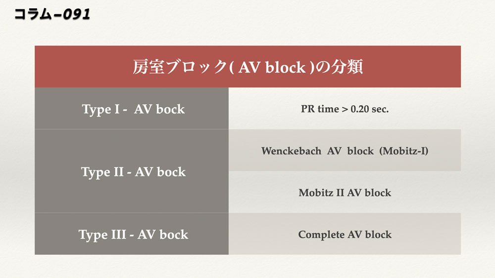 コラム：Sino-atrial exit block Wenckebach type SA block(Mobitz-I型)。 = 心電図検定 ...