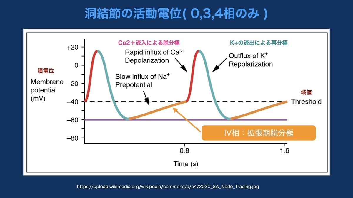 コラム：Sino-atrial exit block Wenckebach type SA block(Mobitz-I型)。 = 心電図検定 ...