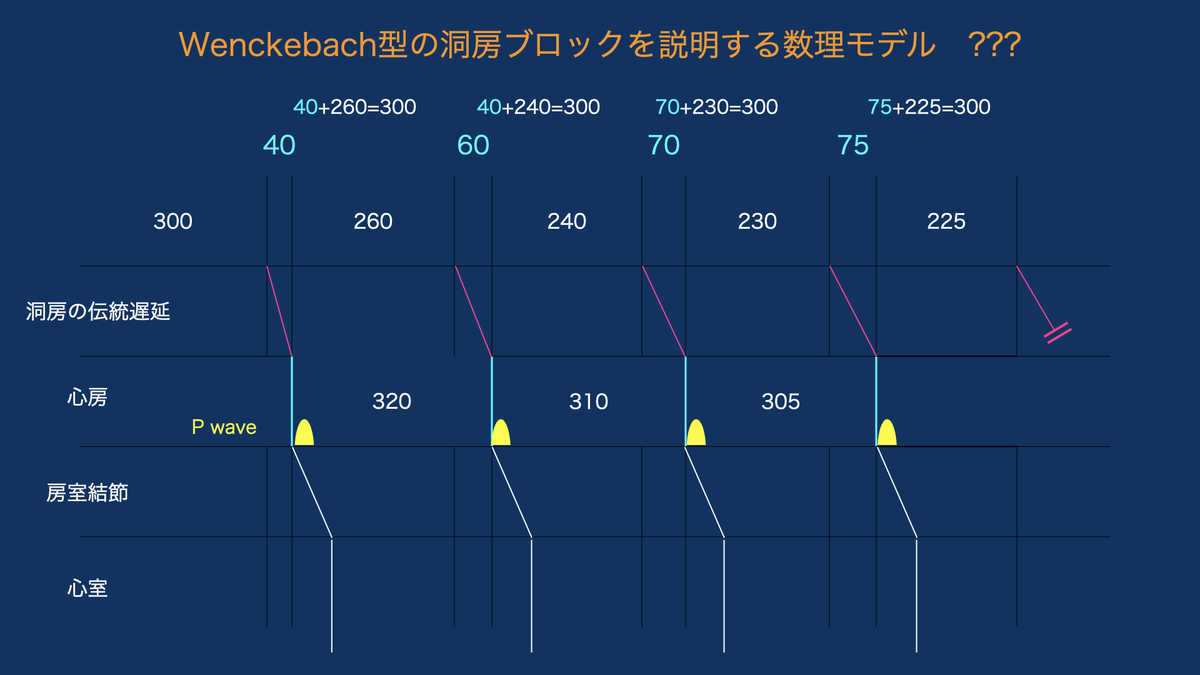 コラム：Sino-atrial exit block Wenckebach type SA block(Mobitz-I型)。 = 心電図検定 ...