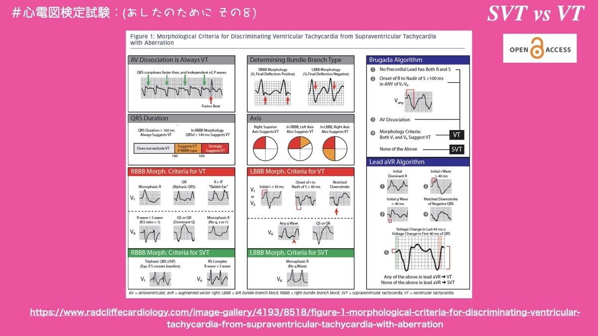 【コラム-151 前編：あしたのために その8-SVT vs VT】 - Cardio2012のECGブログ-2019改