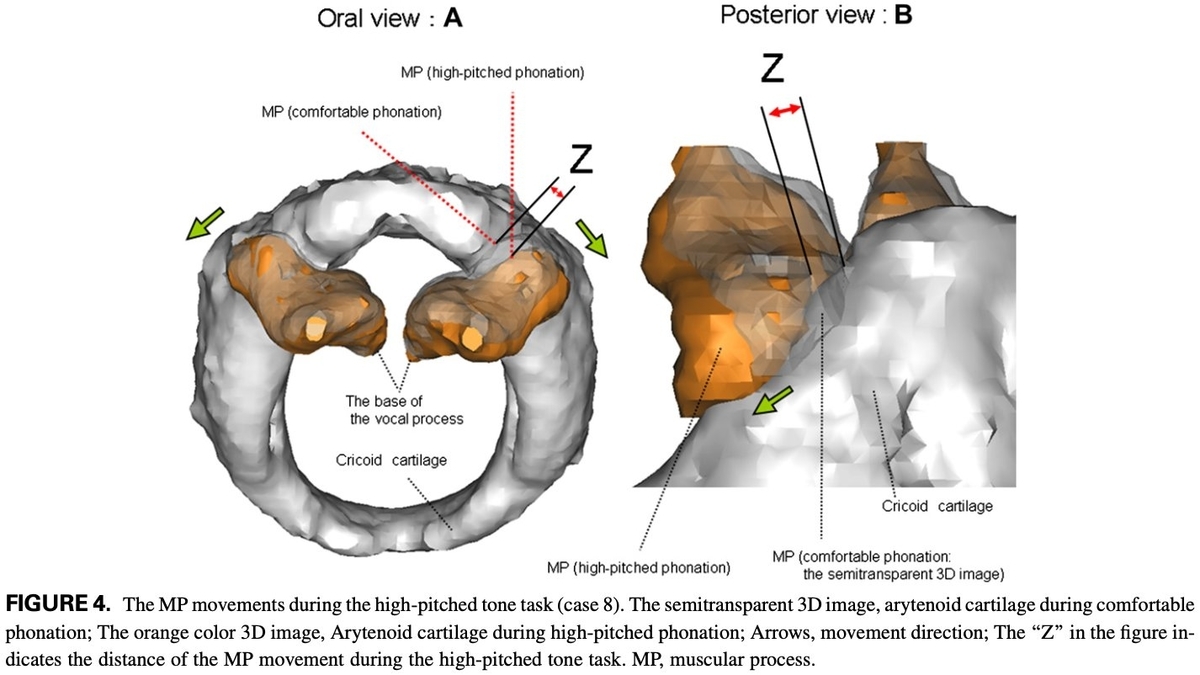 3DCTを使用した高音発声の分析 - huuchiの音楽論文案内