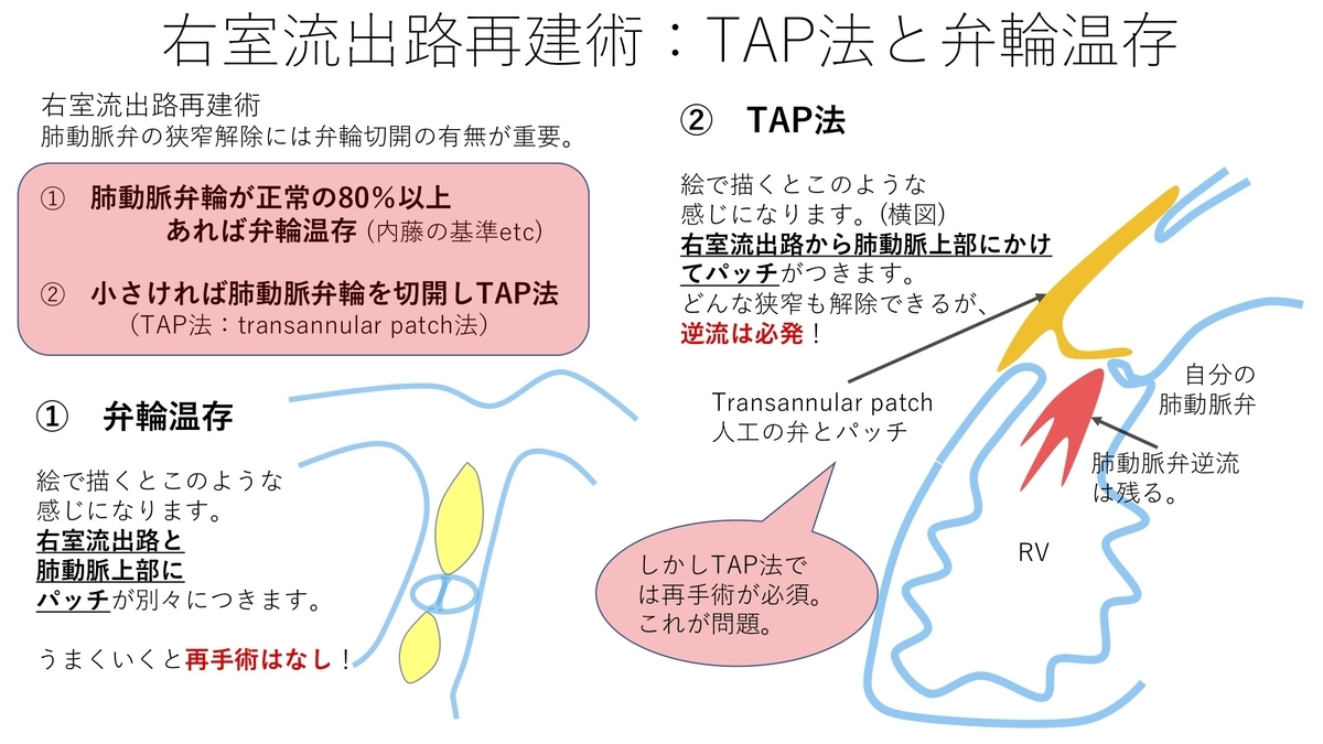 ファロー四徴症( TOF: tetralogy of Fallot ) 臨床経過3 心内修復術について ~ 疾患9 - 誰でもわかる先天性心疾患