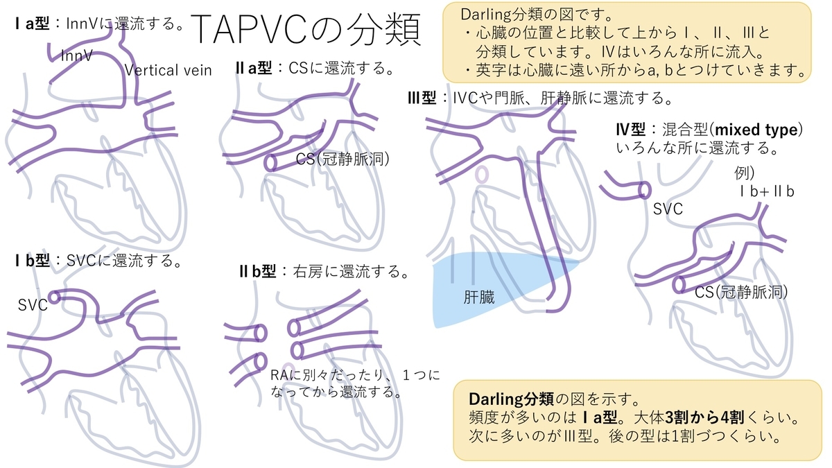 総肺静脈還流異常(TAPVC, TAPVR)について 疾患33 - 誰でもわかる先天性心疾患