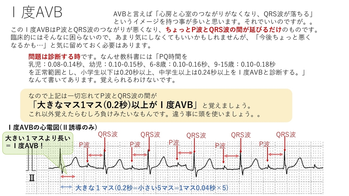 不整脈：房室ブロック(AVB)について その2：Ⅰ、Ⅱ度房室ブロックと高度房室ブロック 〜基本32〜 - 誰でもわかる先天性心疾患