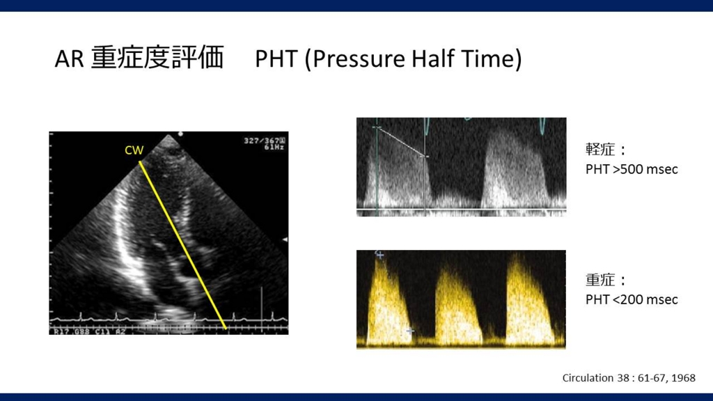 城東病院レクチャー ARについて - コミュニティホスピタリスト＠奈良
