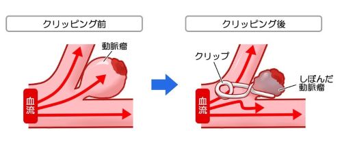 ドクターX初春をはばたく - 天地わたるブログ