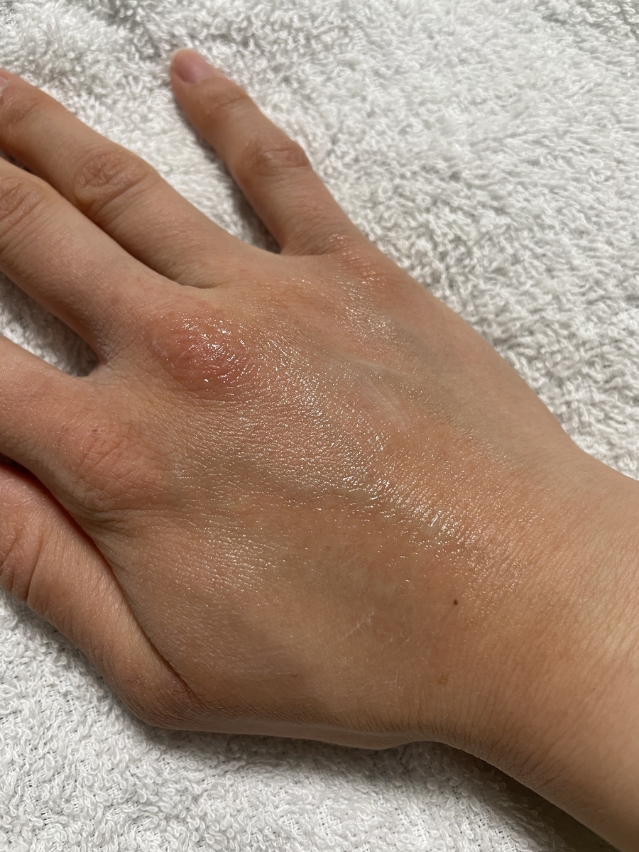 【スキンケア・美容液】ムーサ LU・セラム tia レビュー - maholog