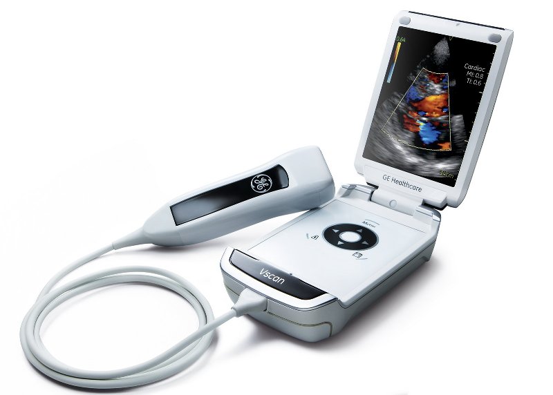 小型診断機器が凄い「Vscan」「VersaCam」 - ゼロツク