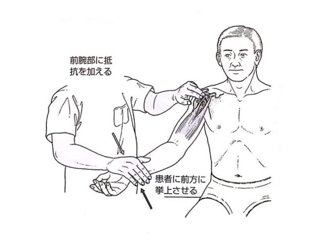 上腕二頭筋腱長頭腱鞘炎〜肩関節周囲炎シリーズ〜 - 整形外科医の勉強日誌