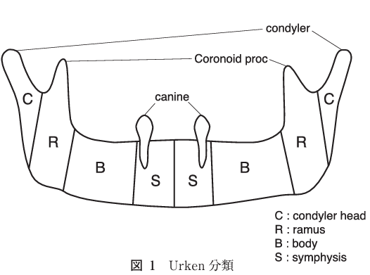 顔面の欠損分類 - haoブログ