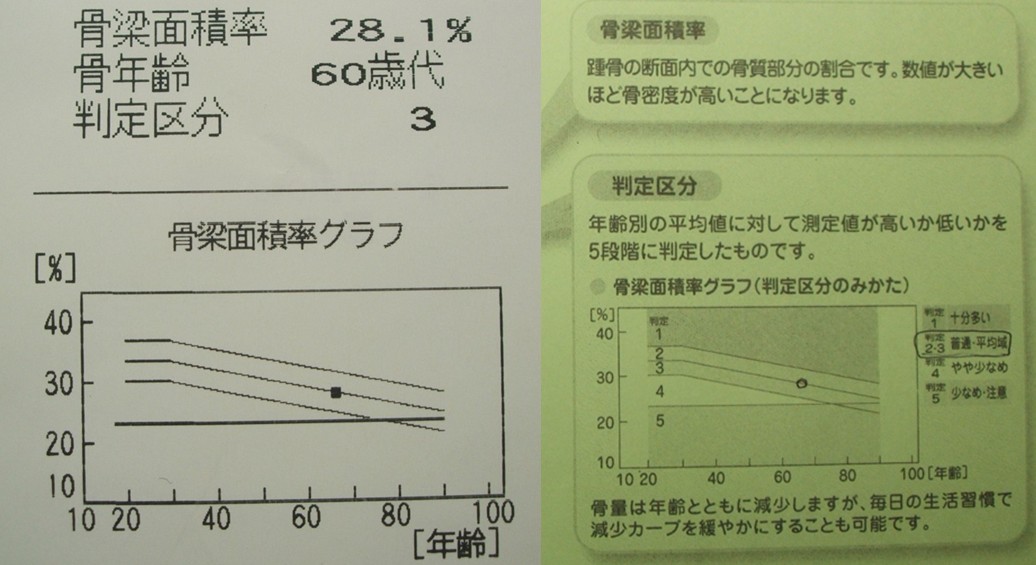 骨密度の測定結果は平均域だった - プチ早期退職者の資産運用＋α
