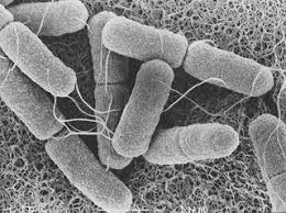 【国内深刻化】またもやO157感染者が！！！男女6人が感染、一人重症。今回の出どことは・・・？O157について徹底調査！予防策も掲載中！ - 暇を充実させ隊！