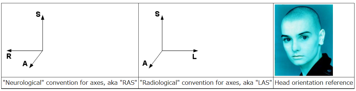 Pythonのパッケージ「dicom2nifti」を使ってDICOMをNIfTIに変換する - 放射線技術×データサイエンス
