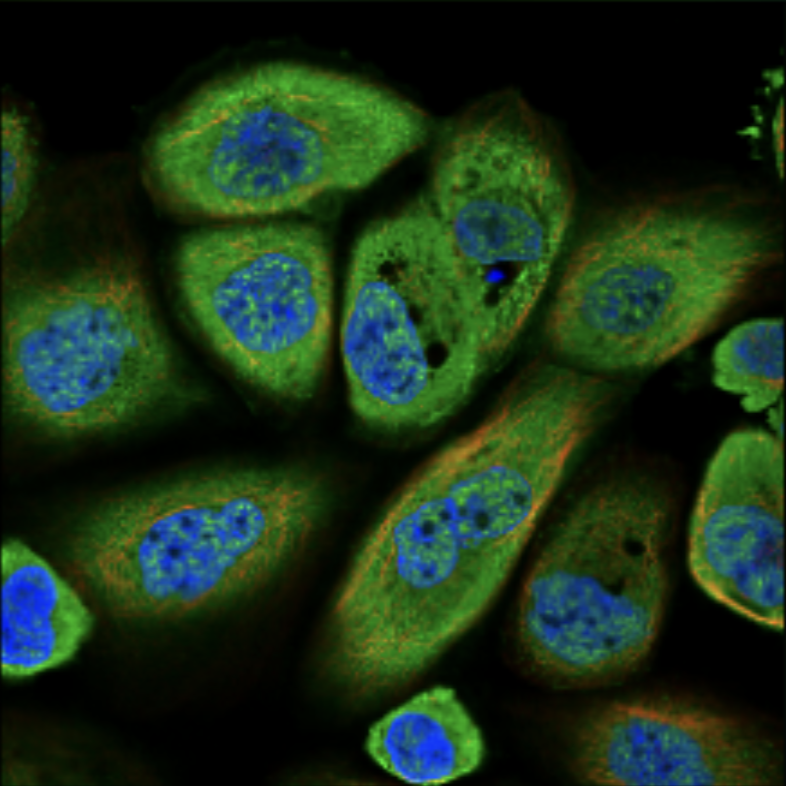 コンペで使える！？LightGBMで実装する3つの弱教師あり学習 - ABEJA Tech Blog