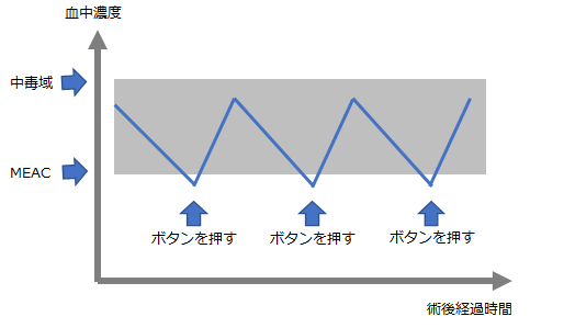 術後PCA - しやいとブログ