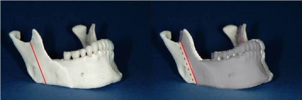 個別「IVRO」の写真、画像 - soe1968's fotolife