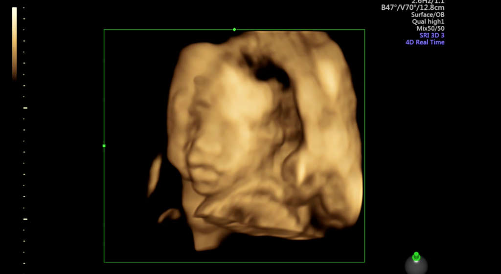 [B!] http://www.contents-marketing-diary.com/entry/2017/08/22/%E3%80%90 ...