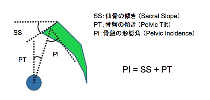 腰椎椎間板ヘルニアになりやすい脊椎・骨盤のアライメントとは？ - リハビリmemo