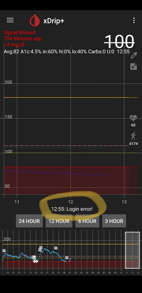 770GのデータをxDrip+からアクセスできないトラブル（追記あり） - 1型でいこう！