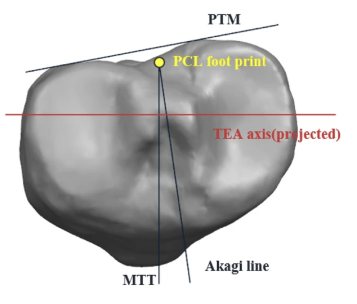 Akagi line TKA作図 - Daily Orthopedics ~整形外科チャンネル~