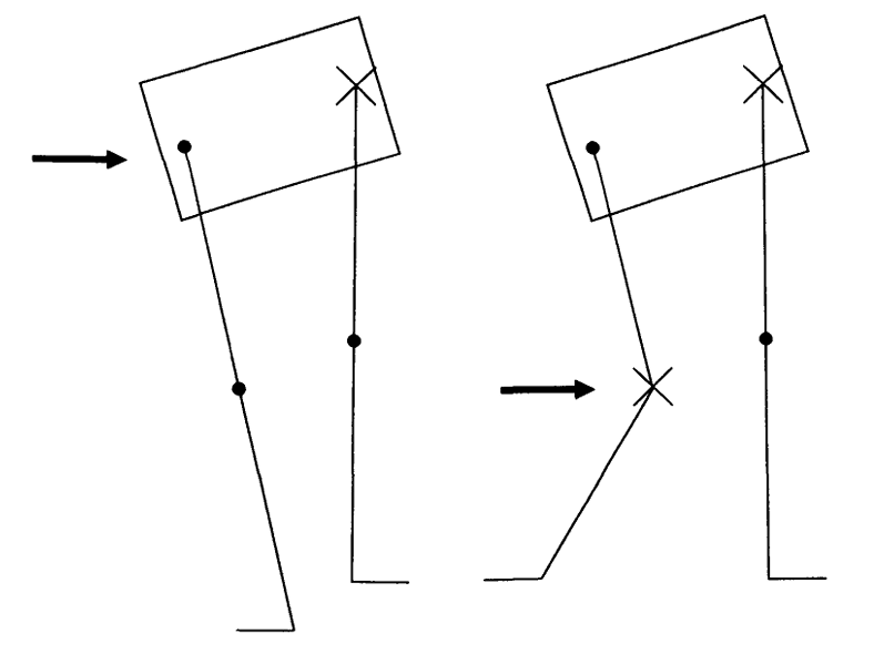 変形性股関節症による変形性膝関節症の合併、Coxitis kneeについて - Daily Orthopedics ~整形外科チャンネル~