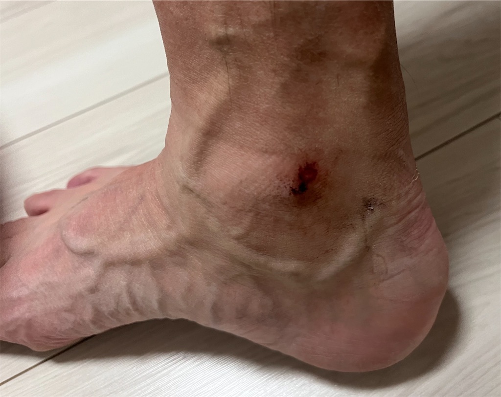 DNF大田原マラソン〜11月23日〜 - ランニング記録だけ