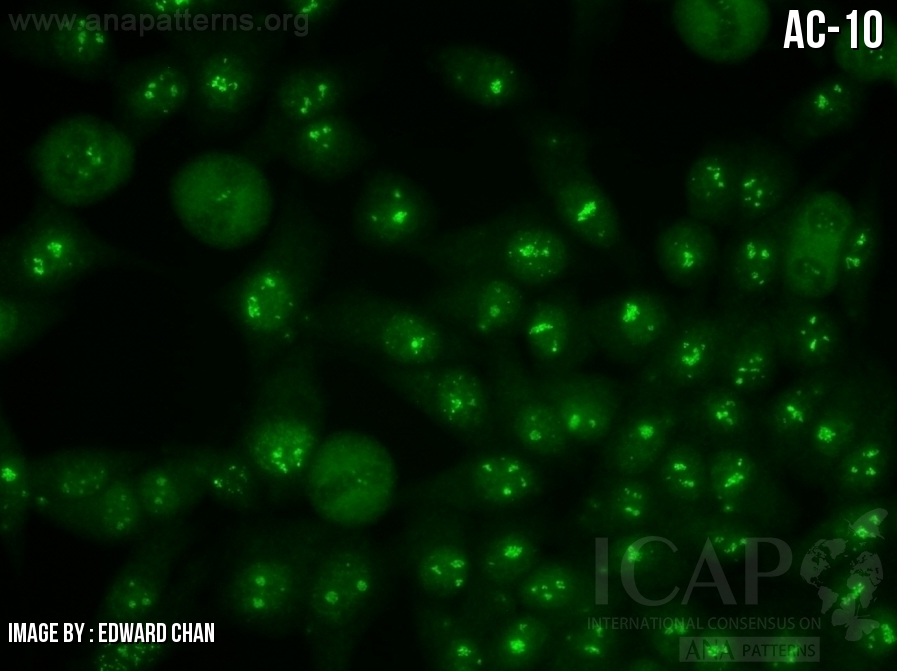 抗核抗体の国際分類基準2019 - リウマチ膠原病徒然日記